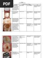 Codigo ICDAS | PDF | Esmalte de dientes | Odontología