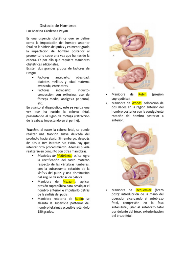 Tema 3. Distocia de Hombros | PDF | Enfermedades y trastornos | Medicina CLINICA