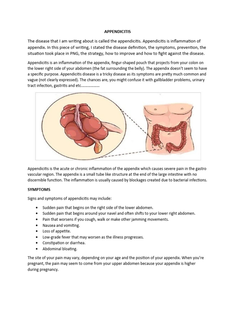 Appendicitis | PDF | Abdomen | Symptoms And Signs