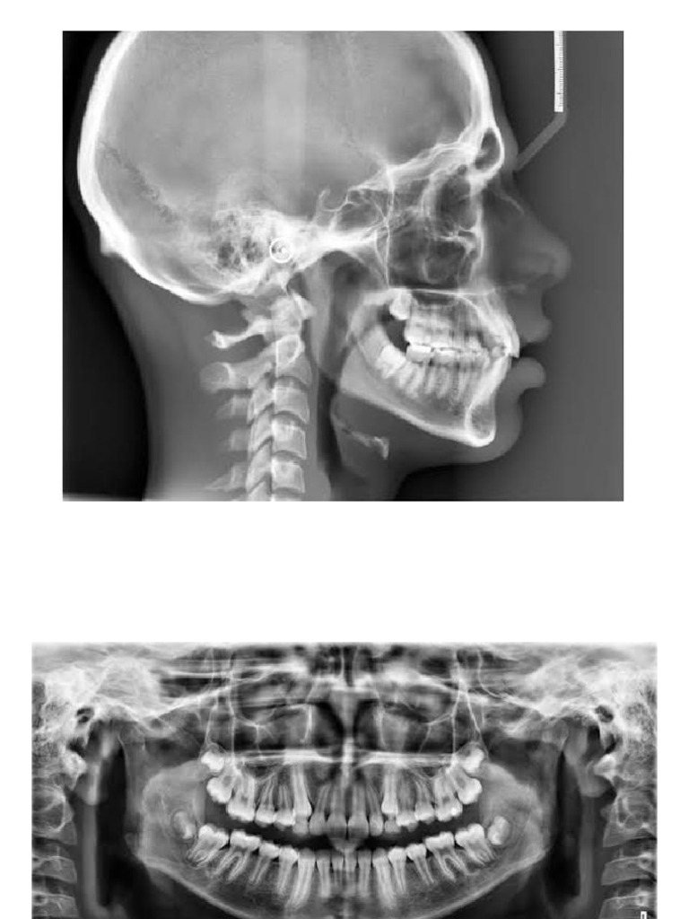 Radiografías Dentales | PDF