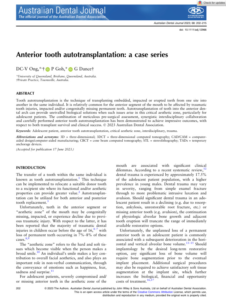 Anterior Tooth Autotransplantation Case Series | PDF | Science ...