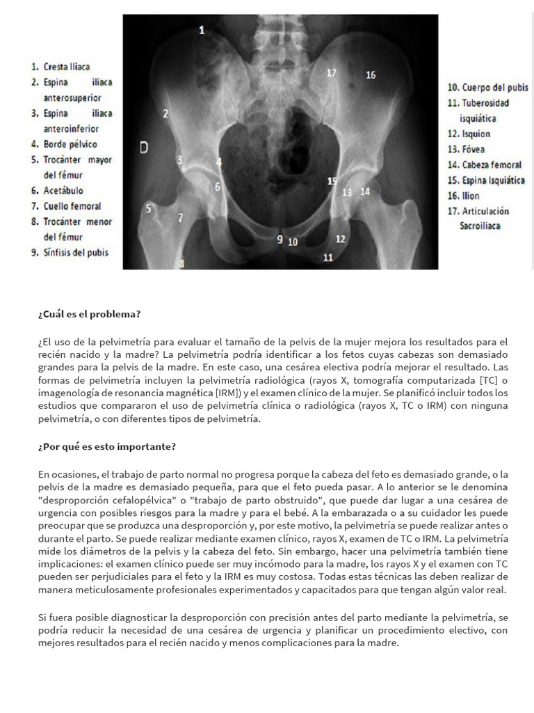Exposicion Pelvimetria | PDF | Imagen de resonancia magnética | Parto