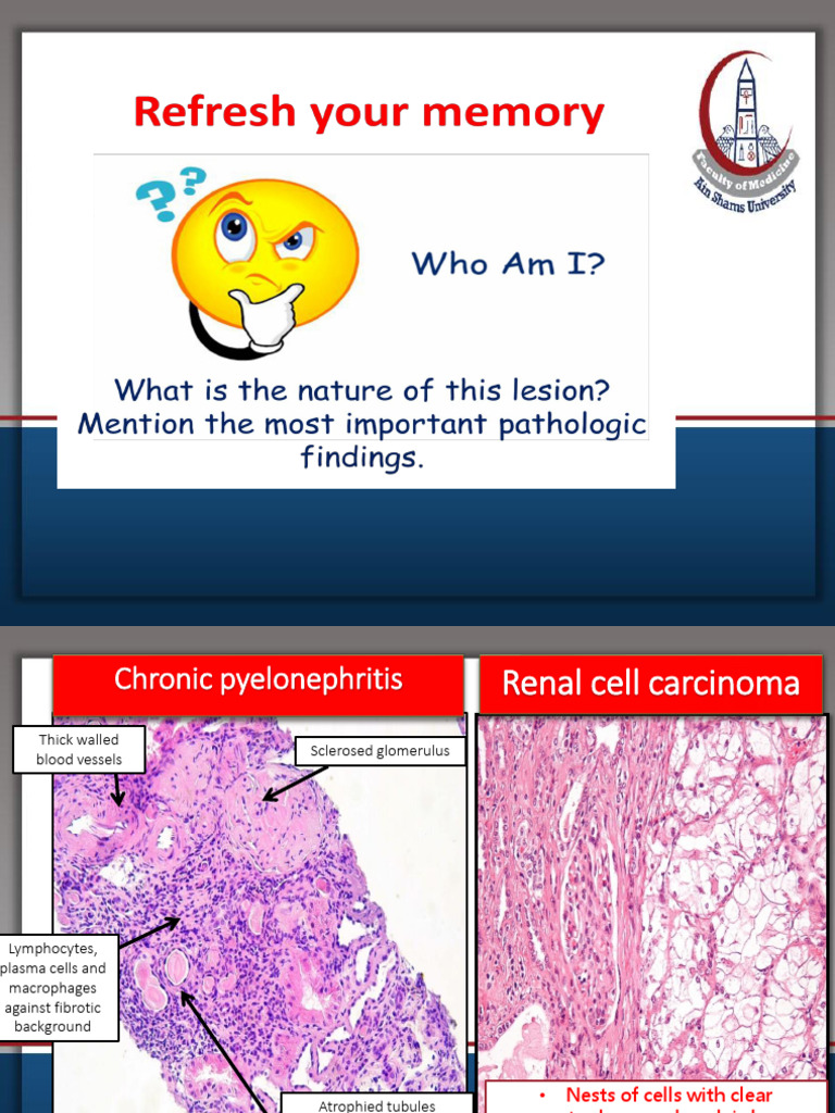 Y3.Female Breast Pathology Lab | PDF | Breast Cancer | Carcinoma