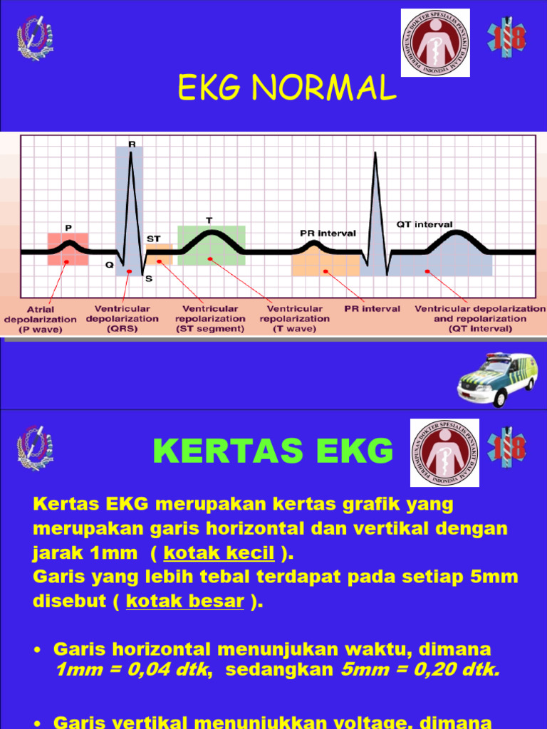 EKG Normal | PDF