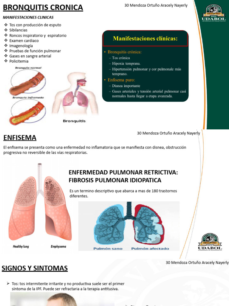 Bronquitis Cronica | PDF