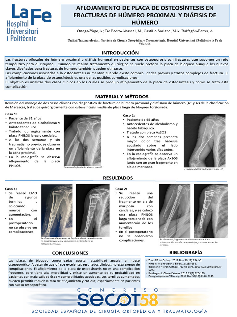 Introducción: Aflojamiento de Placa de Osteosíntesis en Fracturas de ...