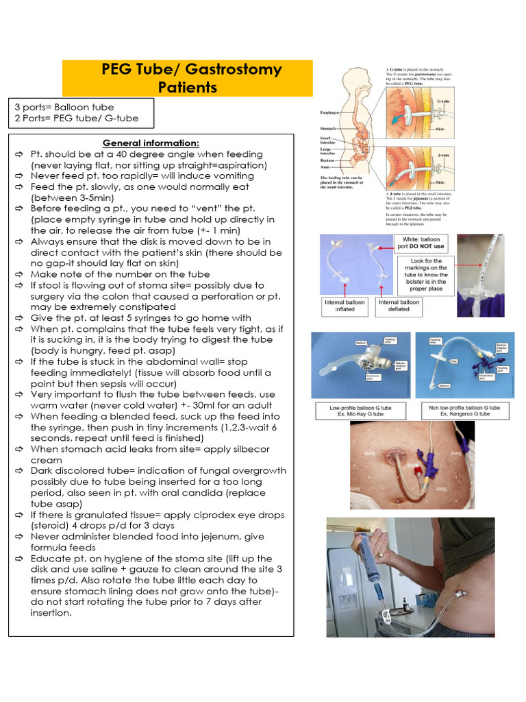 PEG Tube | PDF