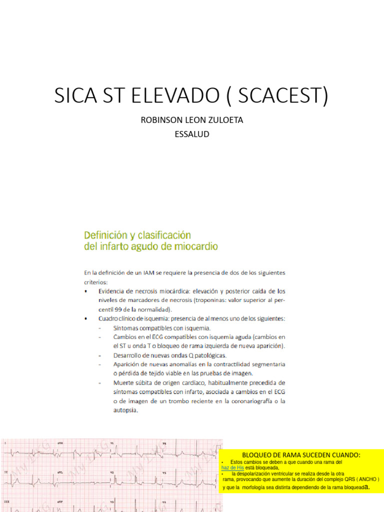 Clase Sica ST Elevado (Scacest) | PDF