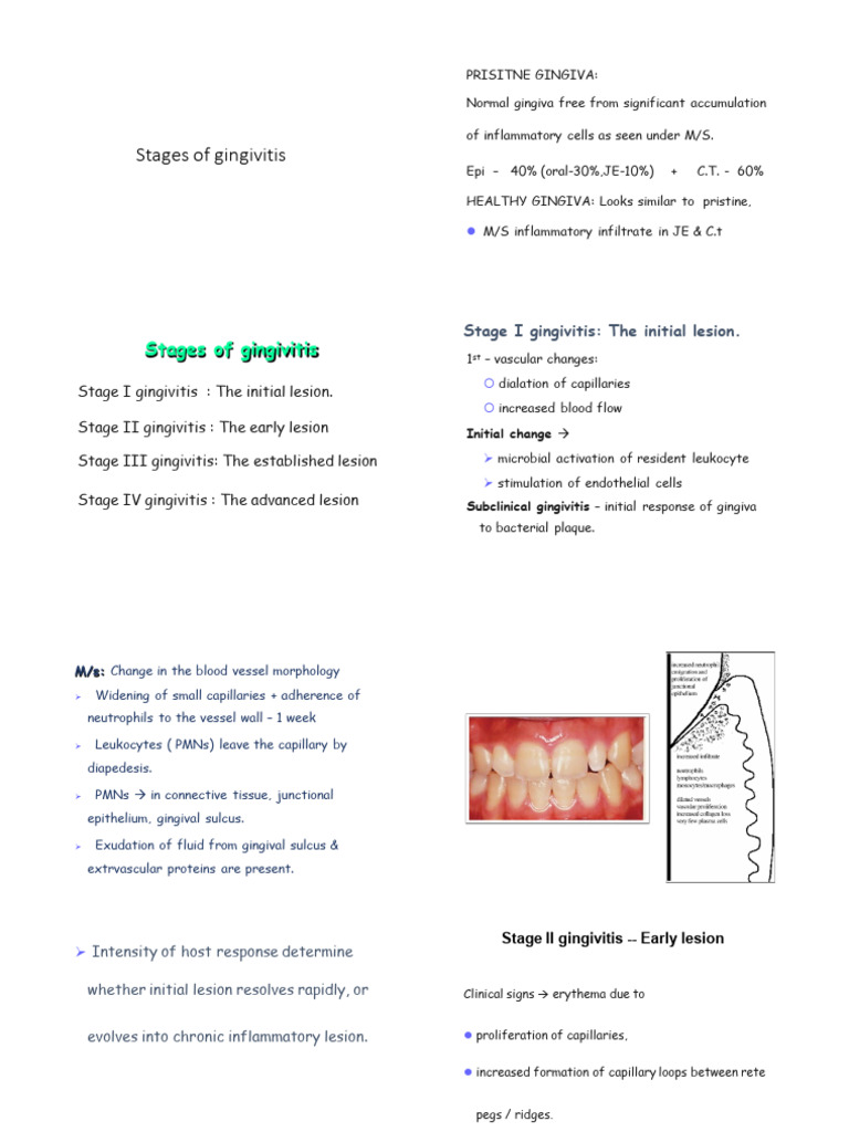 Gingival Inflammation | PDF
