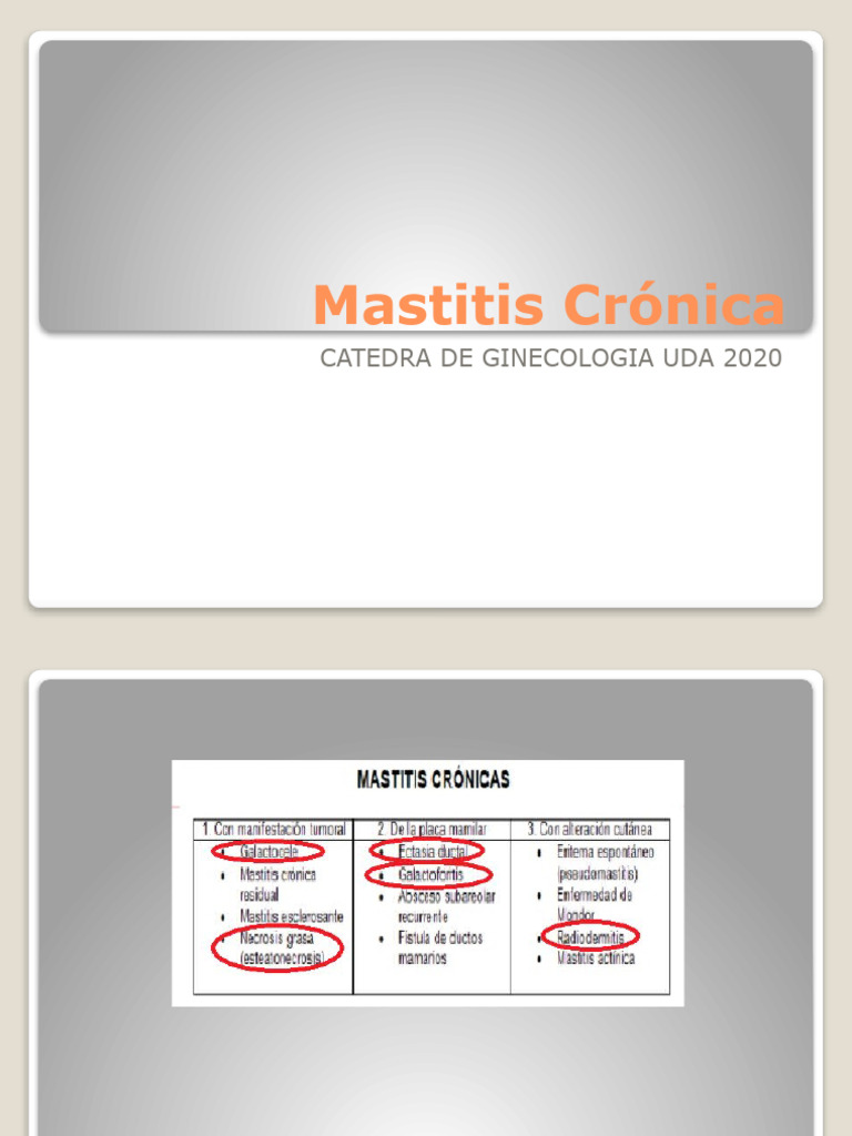 Mastitis Cronica | PDF | Cáncer de mama | Cáncer