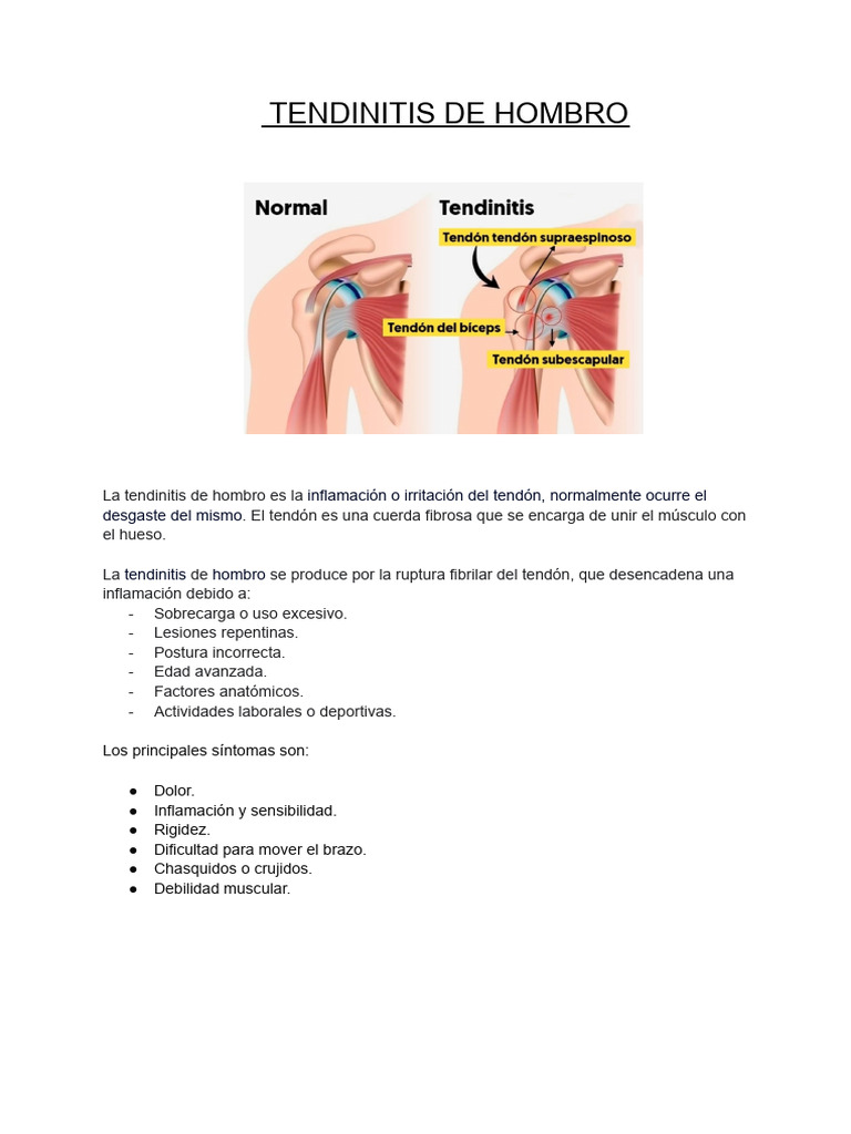 Tipos de dolor en tendinitis de hombro | PDF | Hombro | Medicina CLINICA