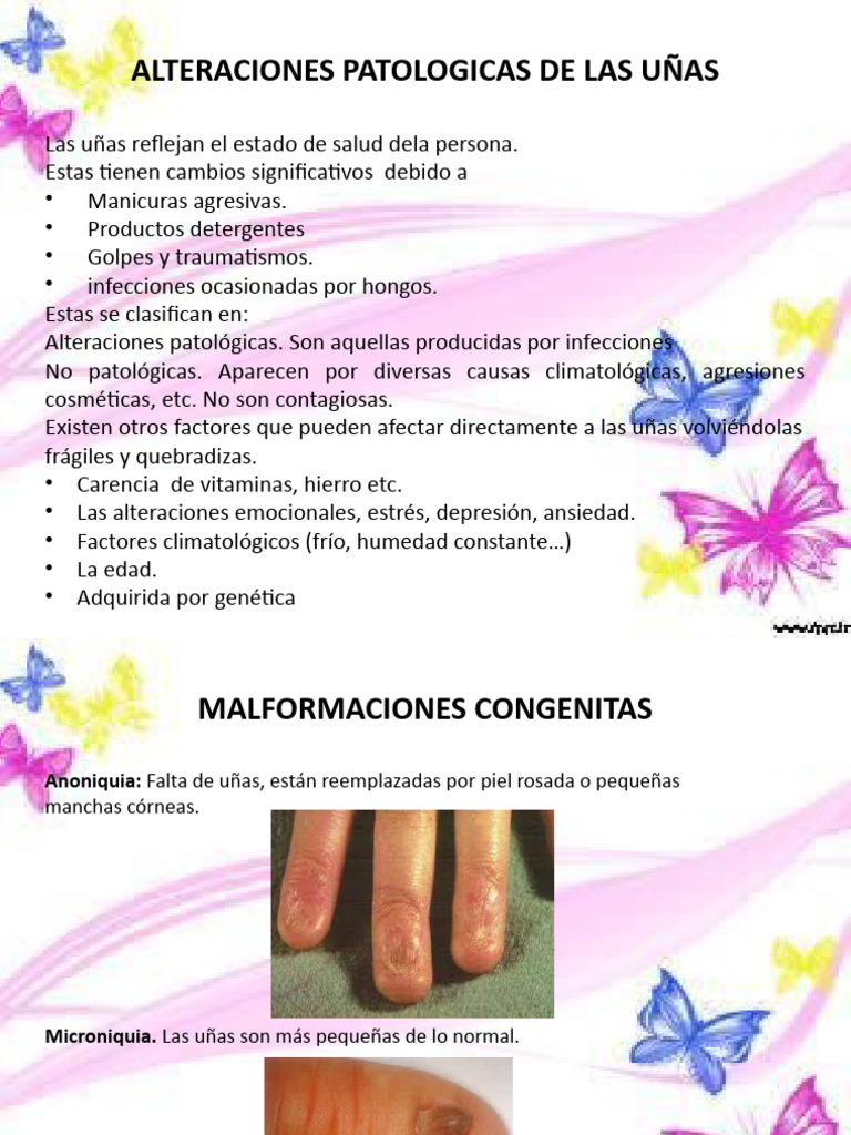 Alteraciones Patológicas de las Uñas | PDF | Clavo (anatomía ...