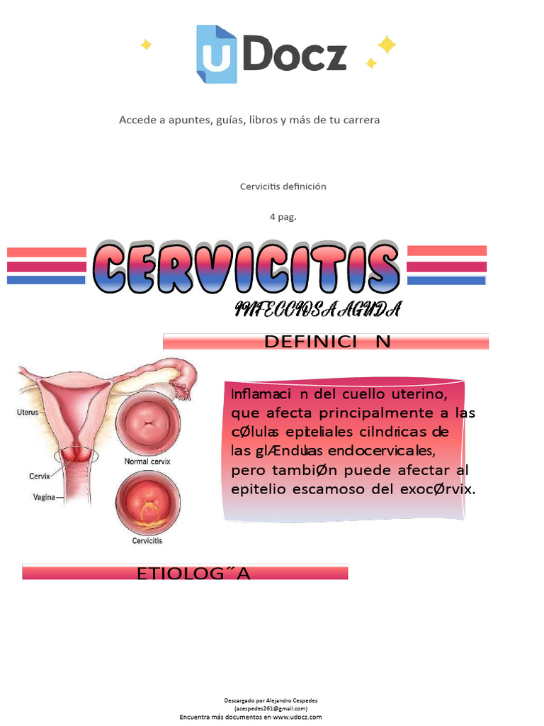 Cervicitis | PDF