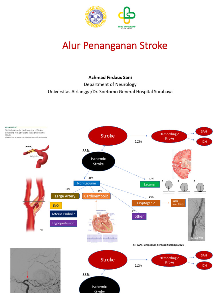 Stroke Pathway Diklat 2022 | PDF