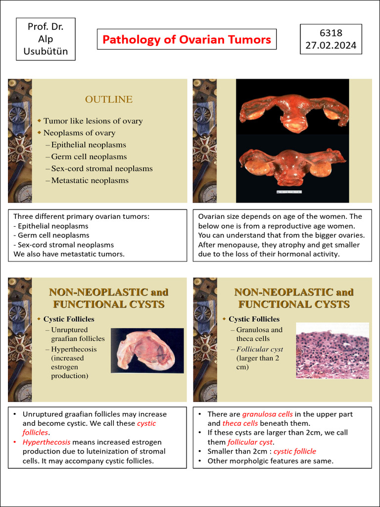 6318 Pathology of Ovarian Tumors | PDF