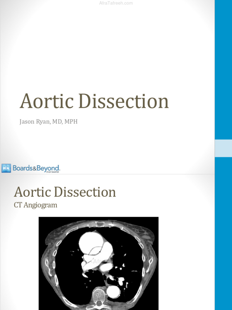 Aortic Dissection Atf | PDF | Aorta | Medical Specialties