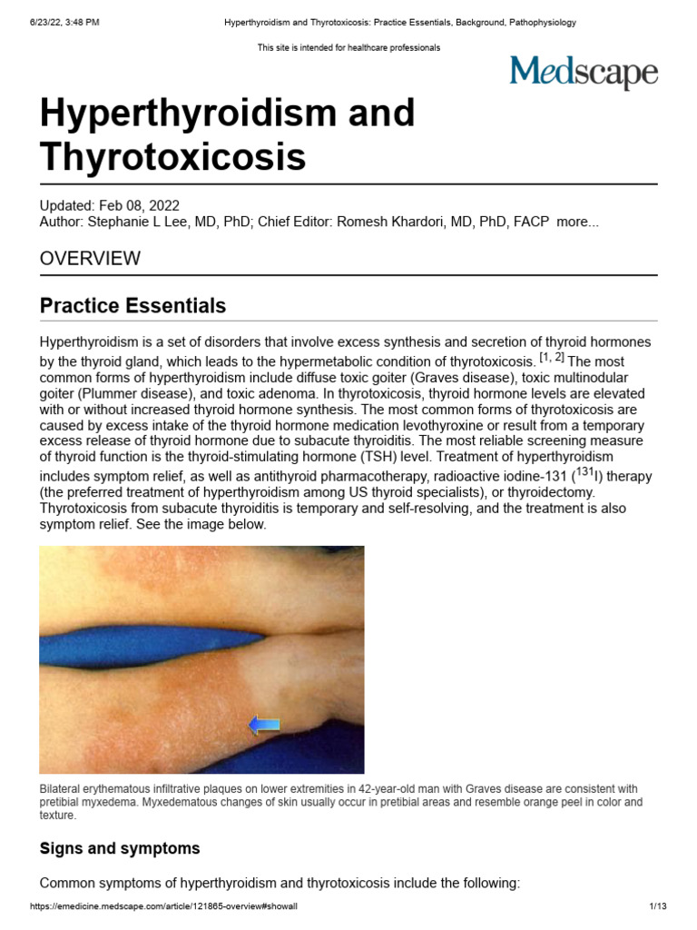 Hyperthyroidism and Thyrotoxicosis - Practice Essentials, Background, Pathophysiology | PDF ...