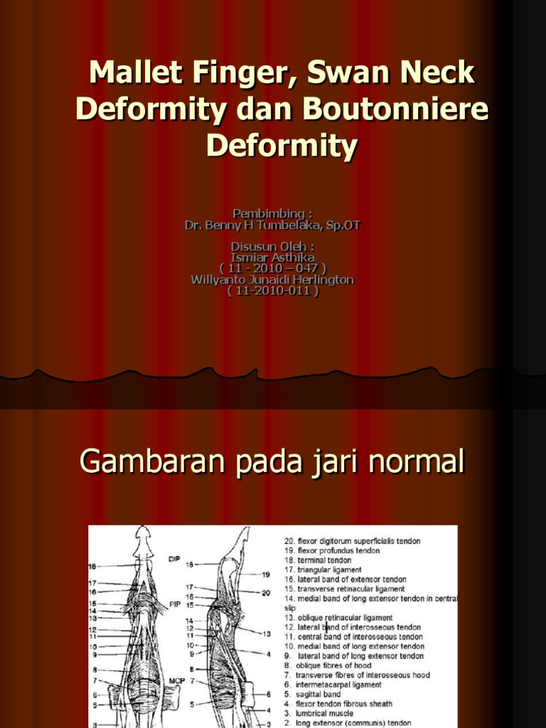 Deformitas Jari: Mallet, Boutonniere, Swan Neck | PDF | Kesehatan Holistik