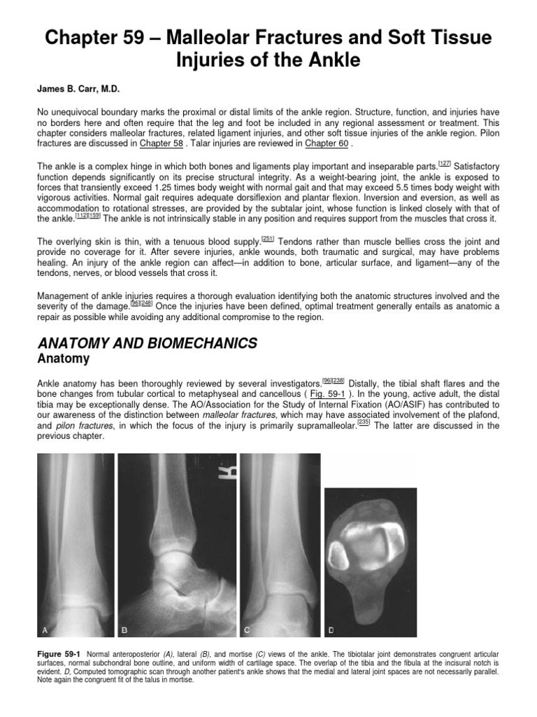 Chapter 59 - Fracturi Maleola - MTOS | PDF | Ankle | Foot