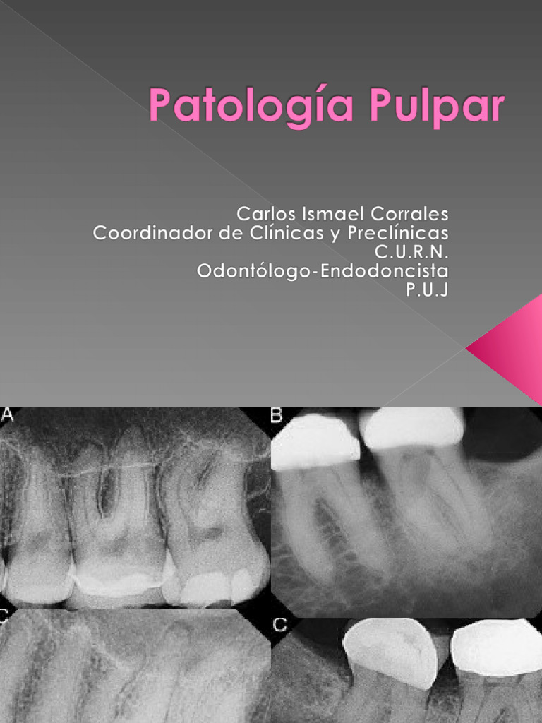 Patología Pulpar | PDF | Inflamación | Hueso