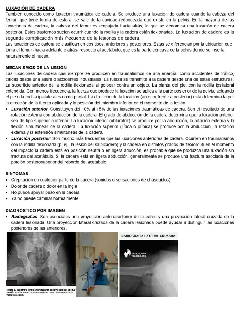 Fractura De Pelvis Y Fémur Pdf