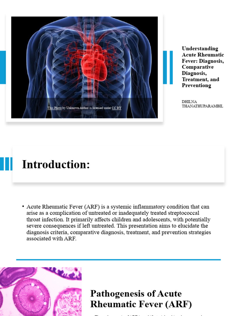 Understanding Acute Rheumatic Fever | PDF | Immune System | Rheumatoid ...
