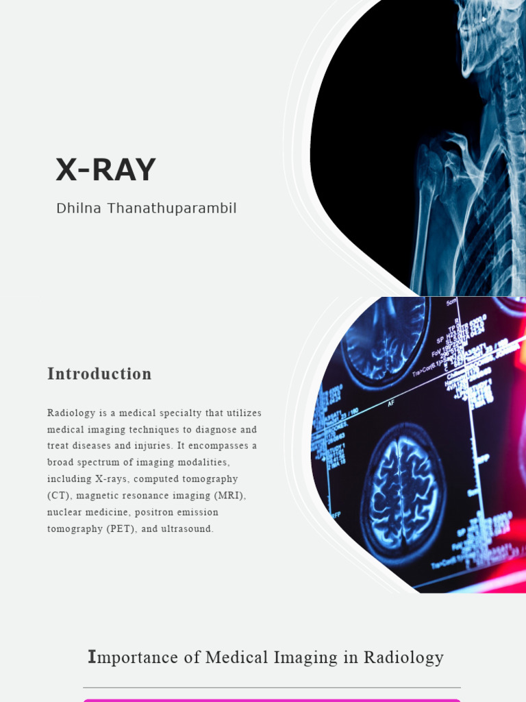 X Ray | PDF | Medical Imaging | Radiology