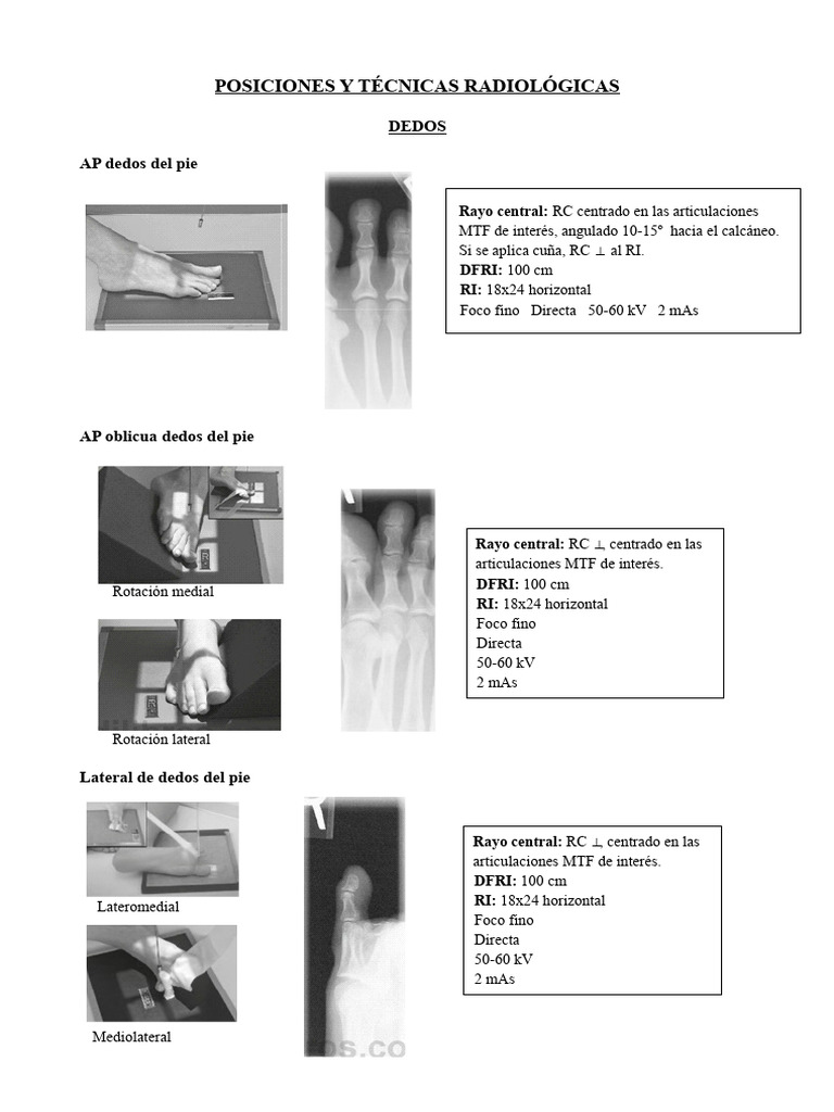 Posiciones y Tecnicas Radiologicas Extremidad Inferior | PDF | Tobillo ...