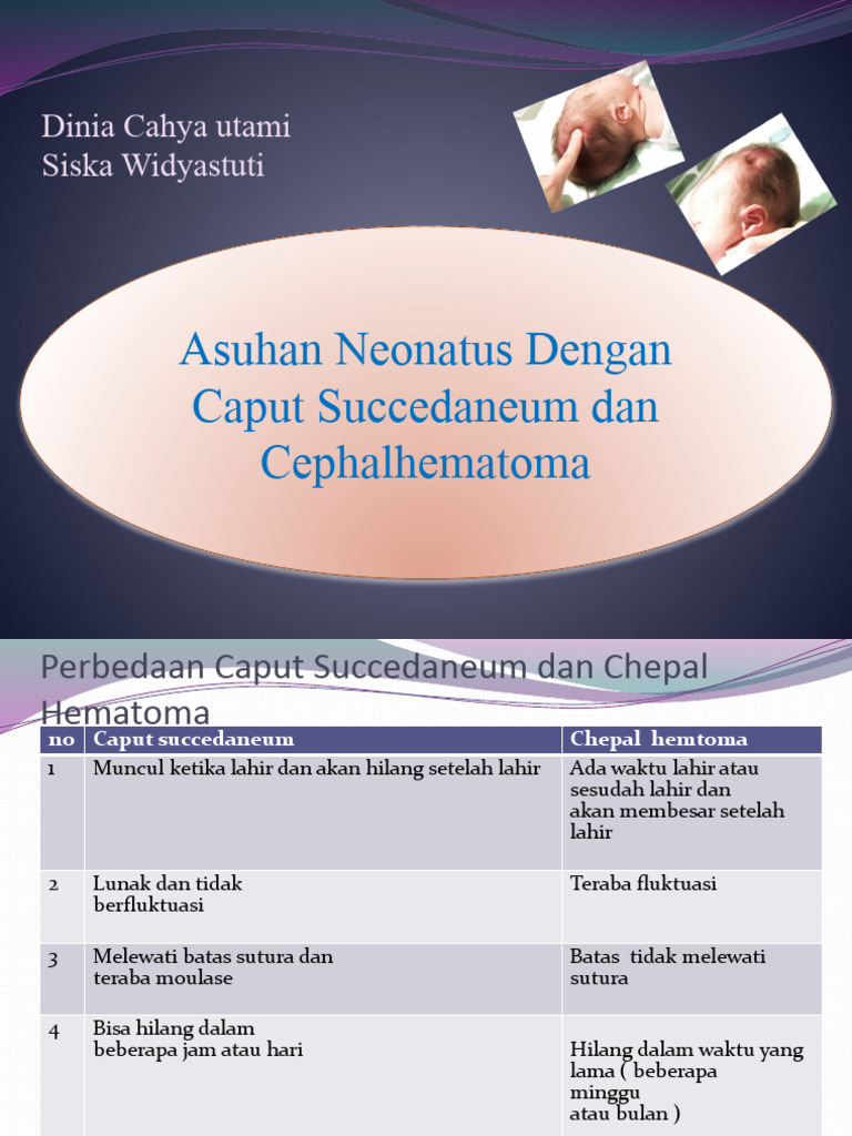 Chepal Hematom PPTX | PDF