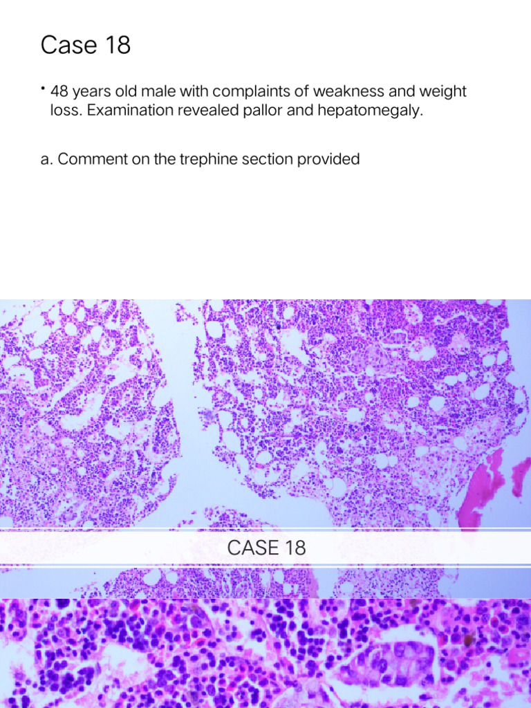 Malignant Haem Cases | PDF | Medicine | Causes Of Death