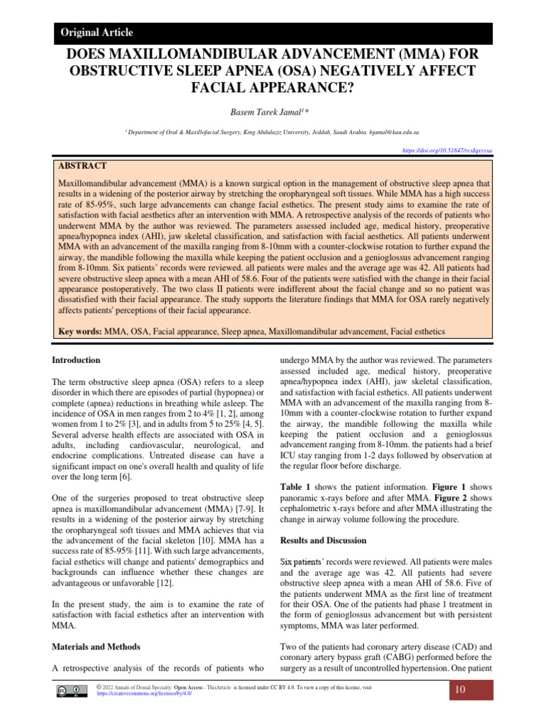 Does Maxillomandibular Advancement (MMA) for Obstructive Sleep Apnea ...