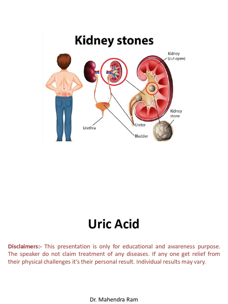 Uric Acid | PDF | Gout | Medical Specialties