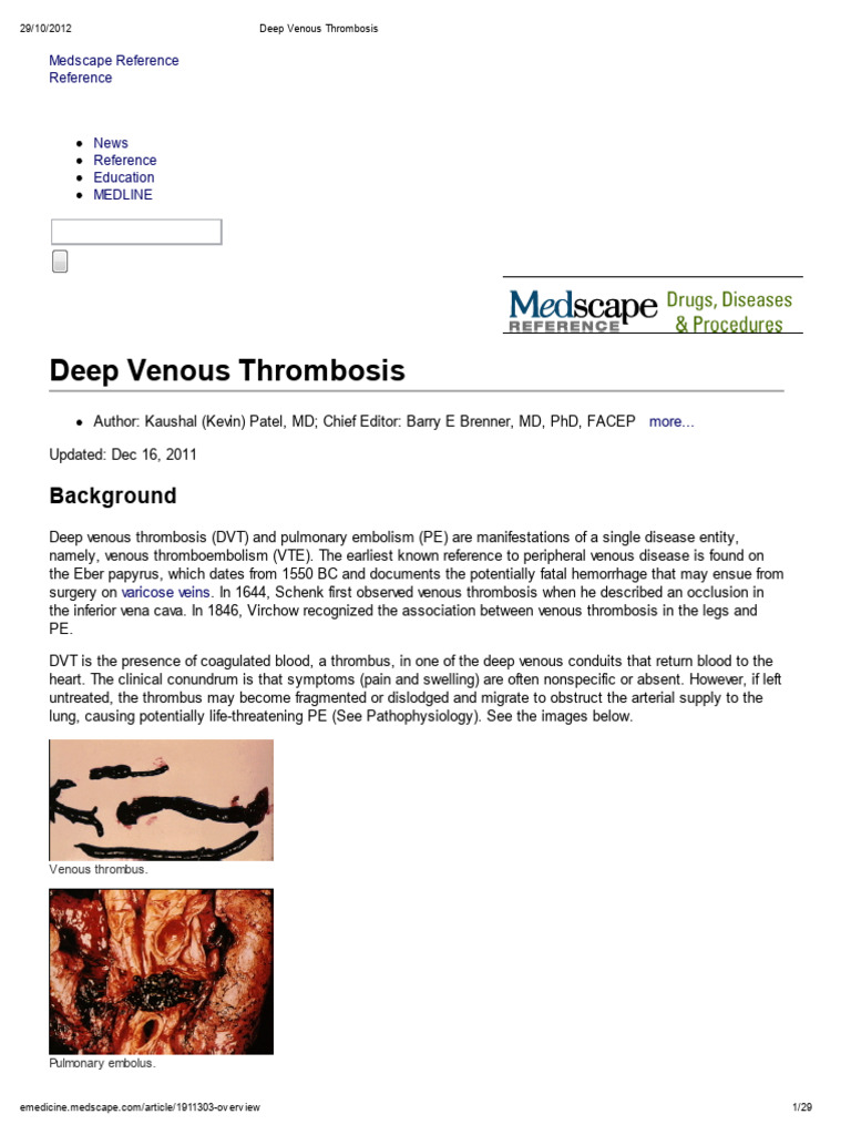 Deep Venous Thrombosis | PDF | Vein | Thrombosis