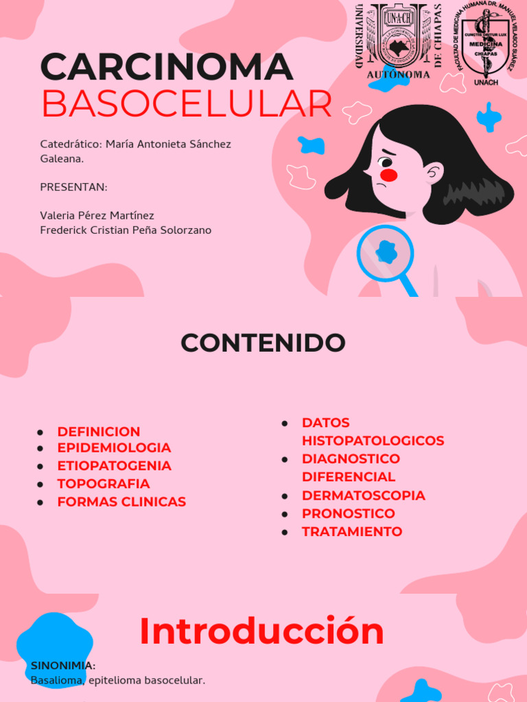 Carcinoma Basocelular: Definición y Tratamiento | PDF | Cáncer | Neoplasias