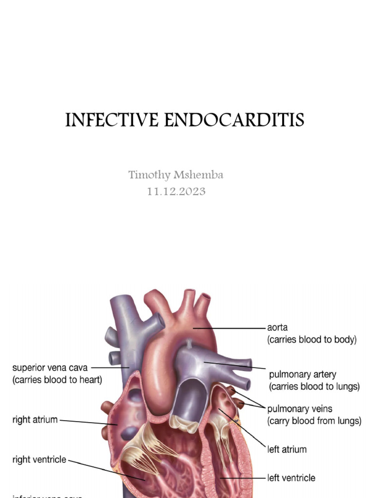 Infective Endocarditis.... Mshemba | PDF | Staphylococcus | Medical Specialties