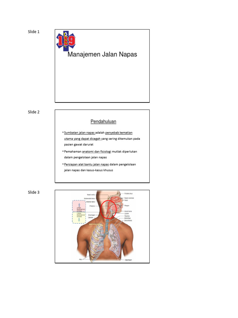 Manajemen Jalan Napas: Slide 1 | PDF