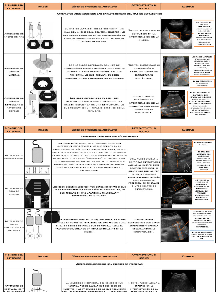 Artefactos ecográficos | PDF | Ultrasonido | Sonido