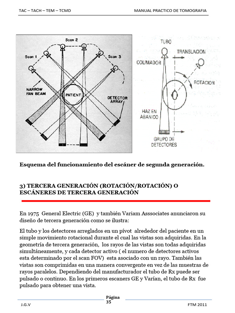 Dividido 20240307 0717 1 | PDF | Ct Scan