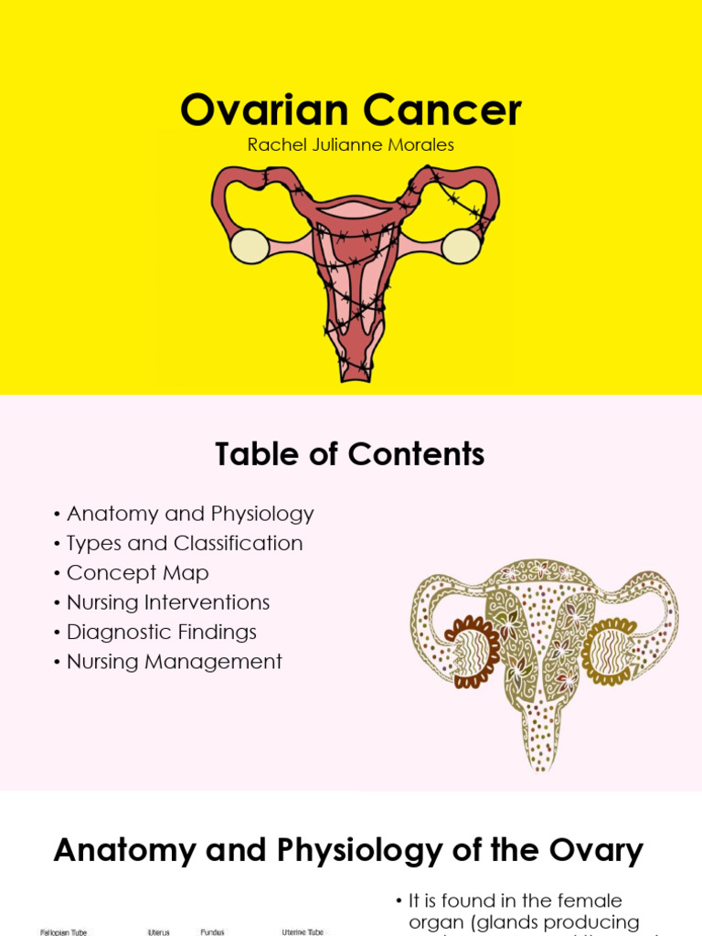 Ovarian Cancer | PDF