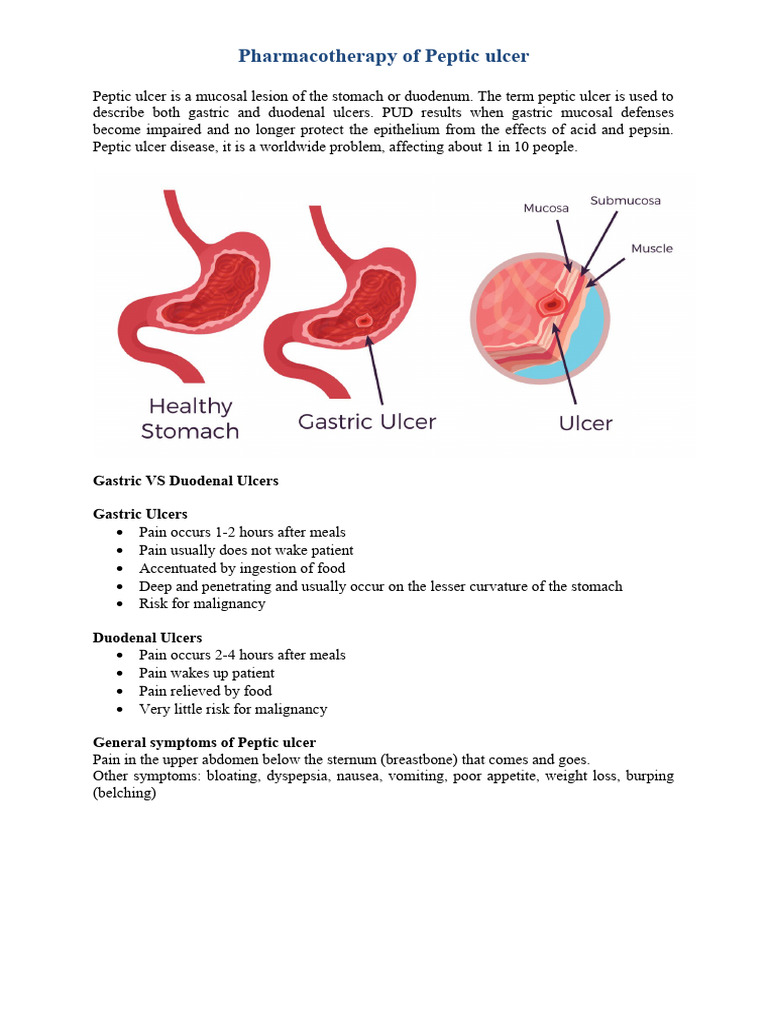 Peptic Ulcer Pharmacotherapy Guide | PDF