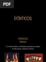 Tipos y funciones del póntico en prótesis fija | PDF | Dentadura ...