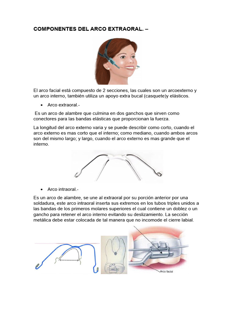 Componentes Del Arco Extraoral | PDF