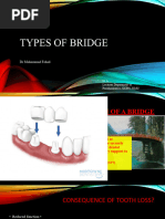Fixed Prosthodontics - Types of Dental Bridges (FPD) | PDF | Dentistry ...