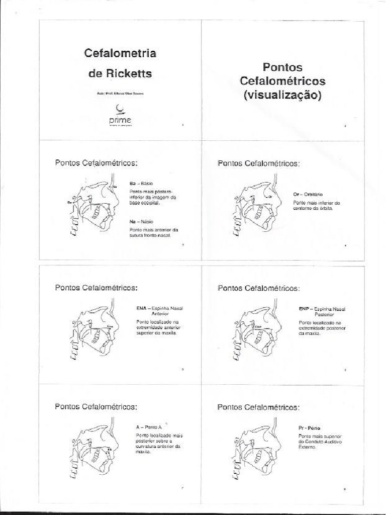 Análise De Ricketts Pdf