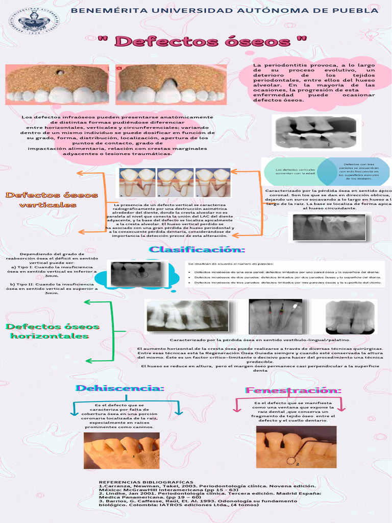 Defectos Óseos | PDF | Hueso | Especialidades Medicas