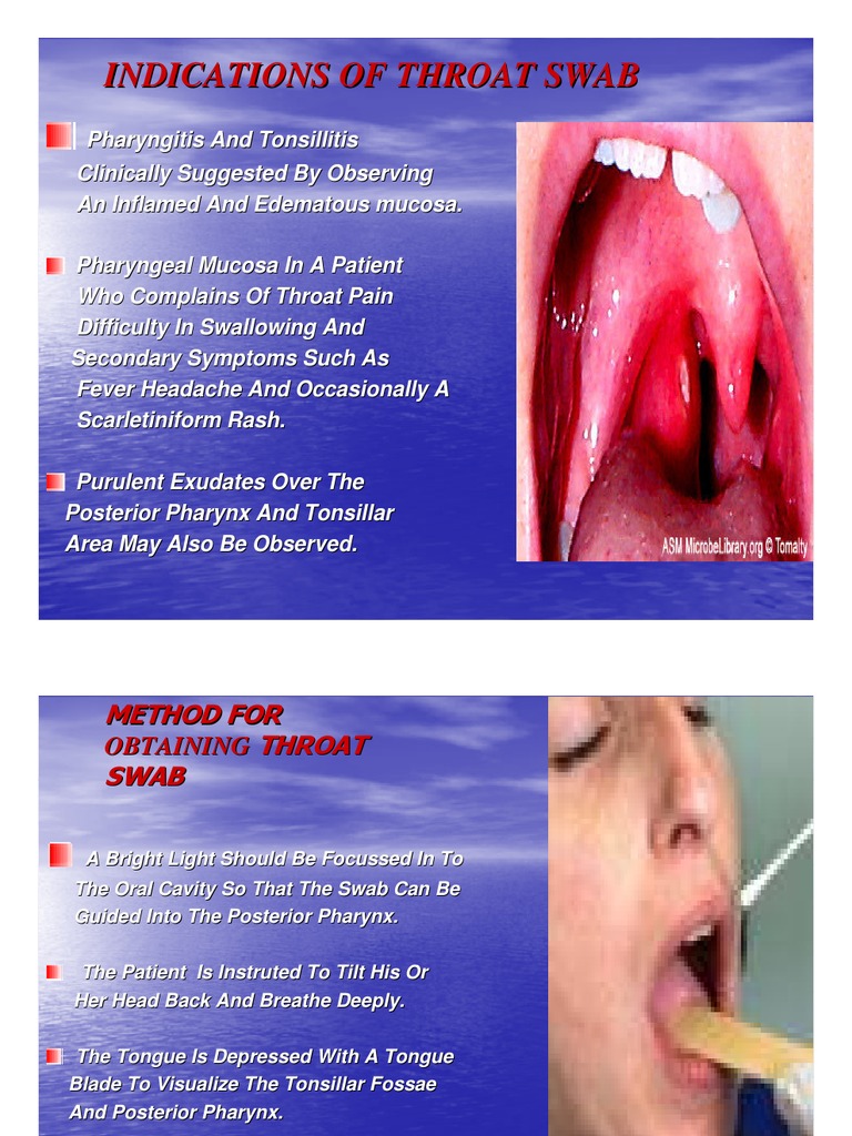 Throat Swab Indications and Procedure | PDF | Streptococcus | Health ...
