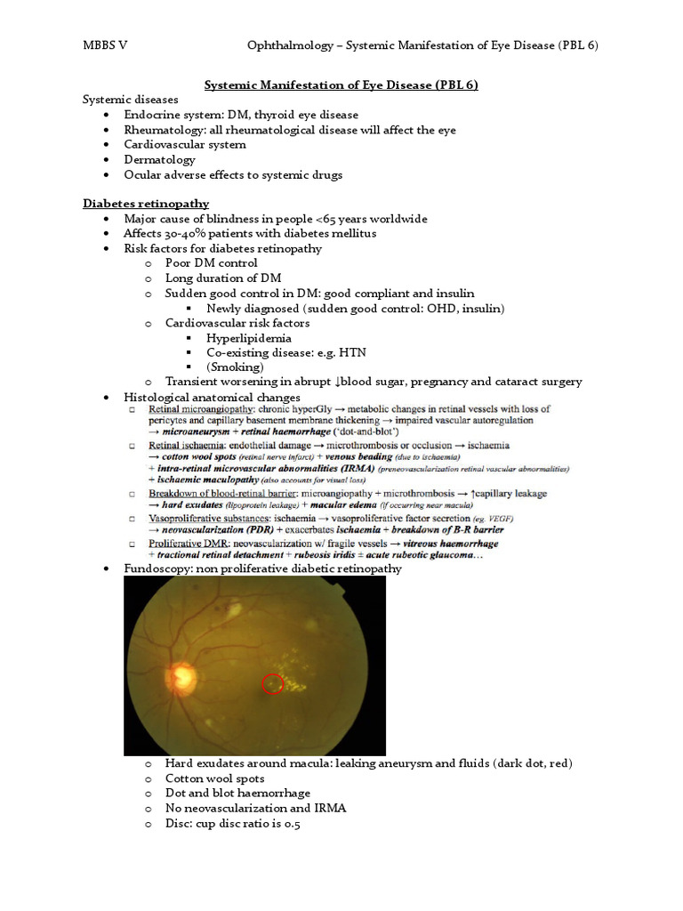 Ophthalmology - Systemic Manifestation of Eye Disease PBL Case 6 | PDF ...