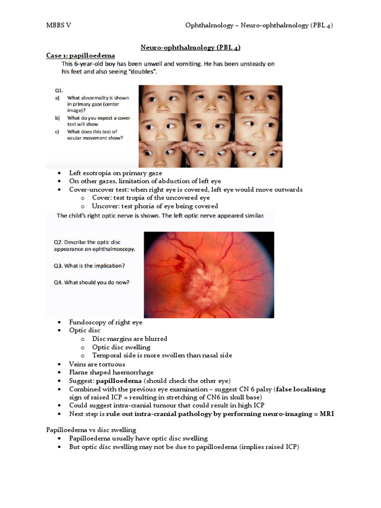 Ophthalmology - Neuro-Ophthalmology PBL Case 4 | PDF | Human Eye | Ophthalmology