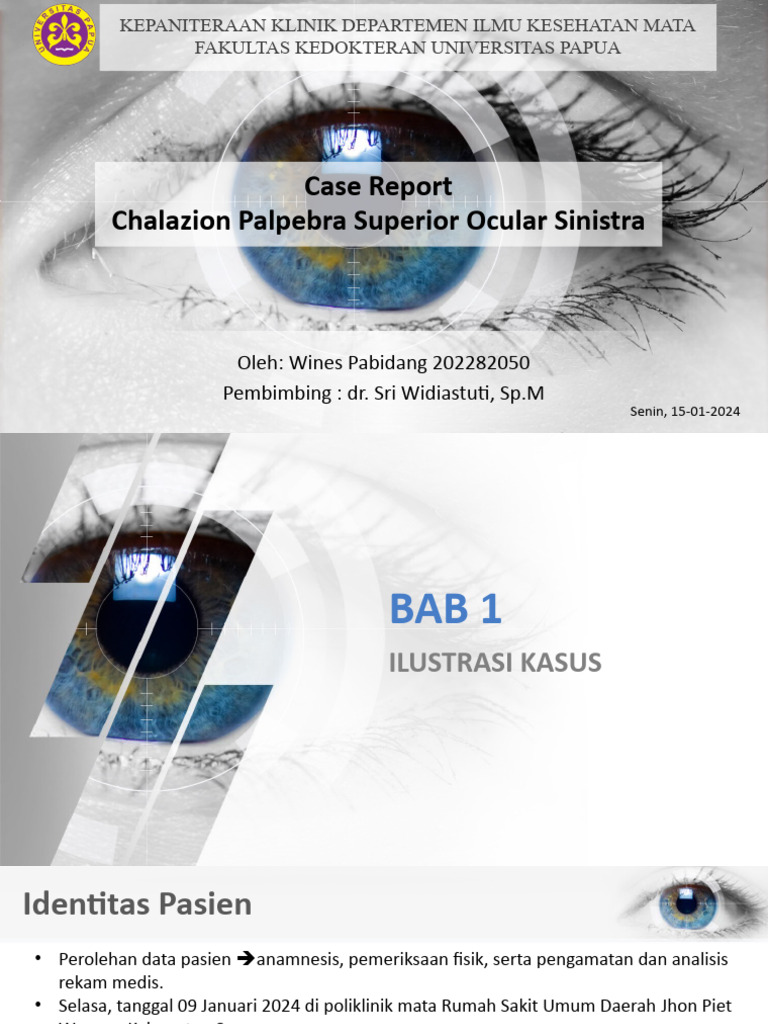 Kalazion Palpebra Superior: Kasus dan Tatalaksana | PDF