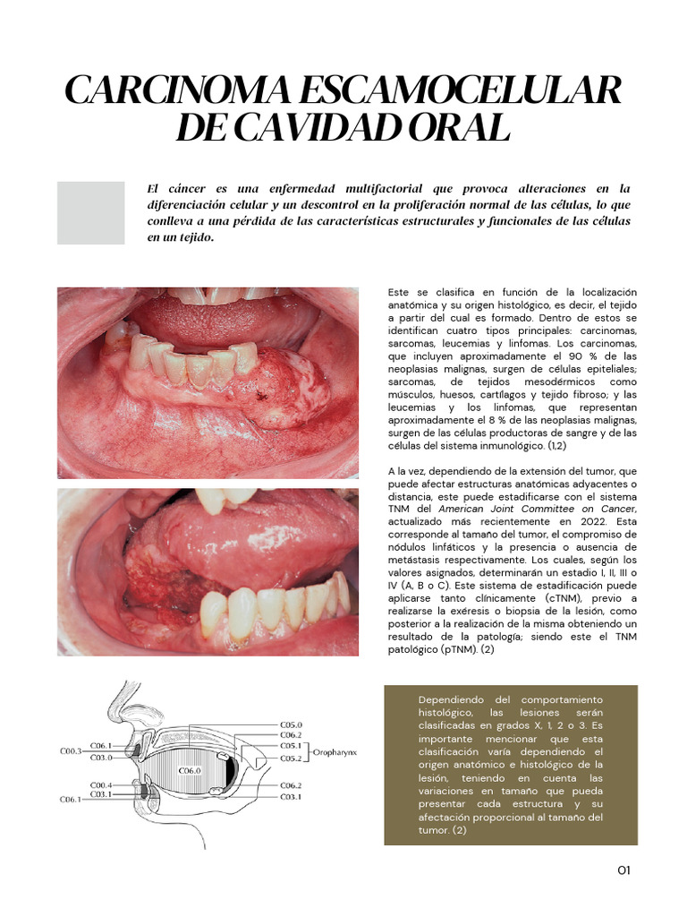 Carcinoma Escamocelular de Cavidad Oral | PDF | Cáncer | Sistema inmune